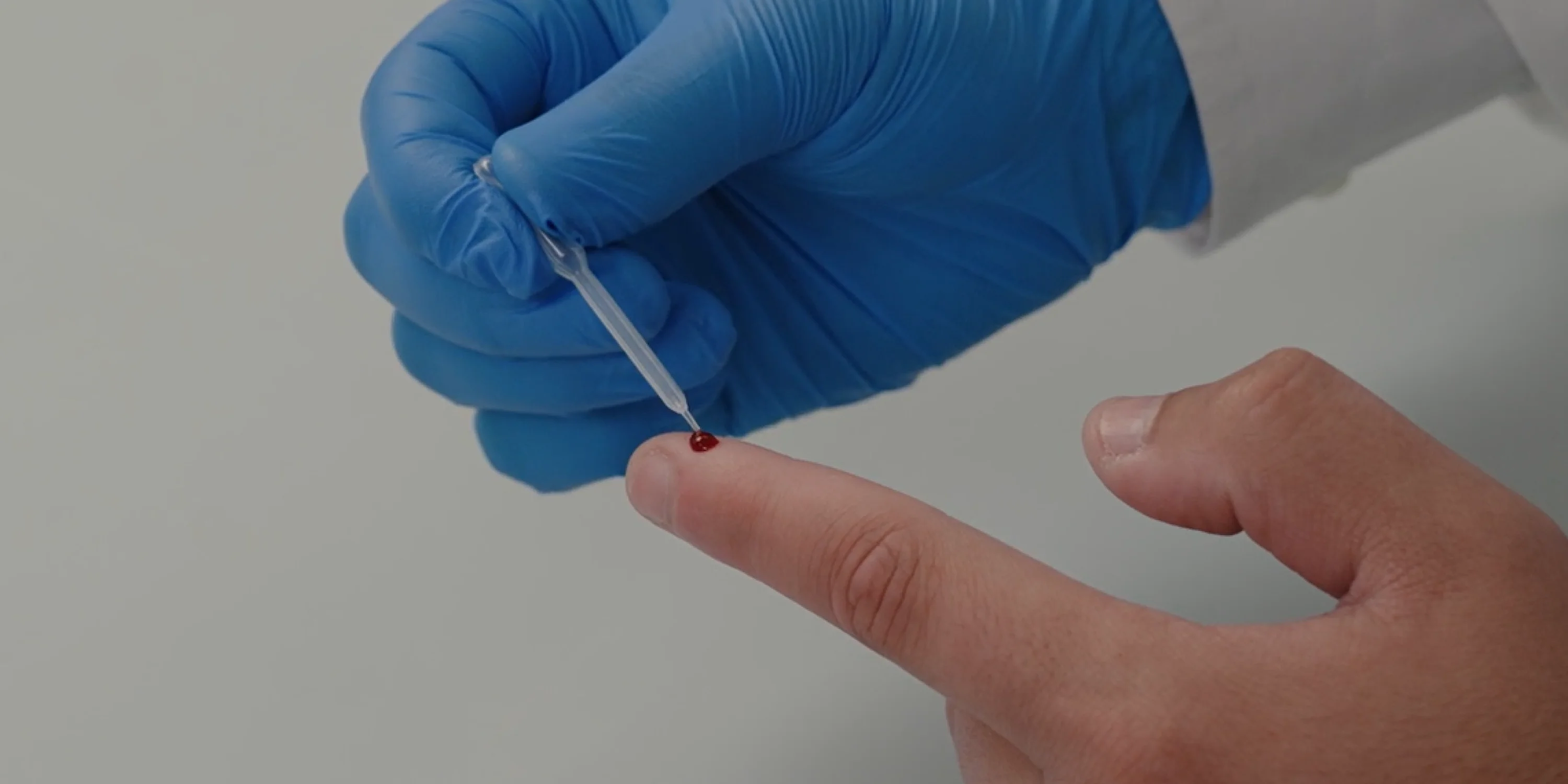 InTec Rapid Anti-HCV Test | Blog | AttoSure