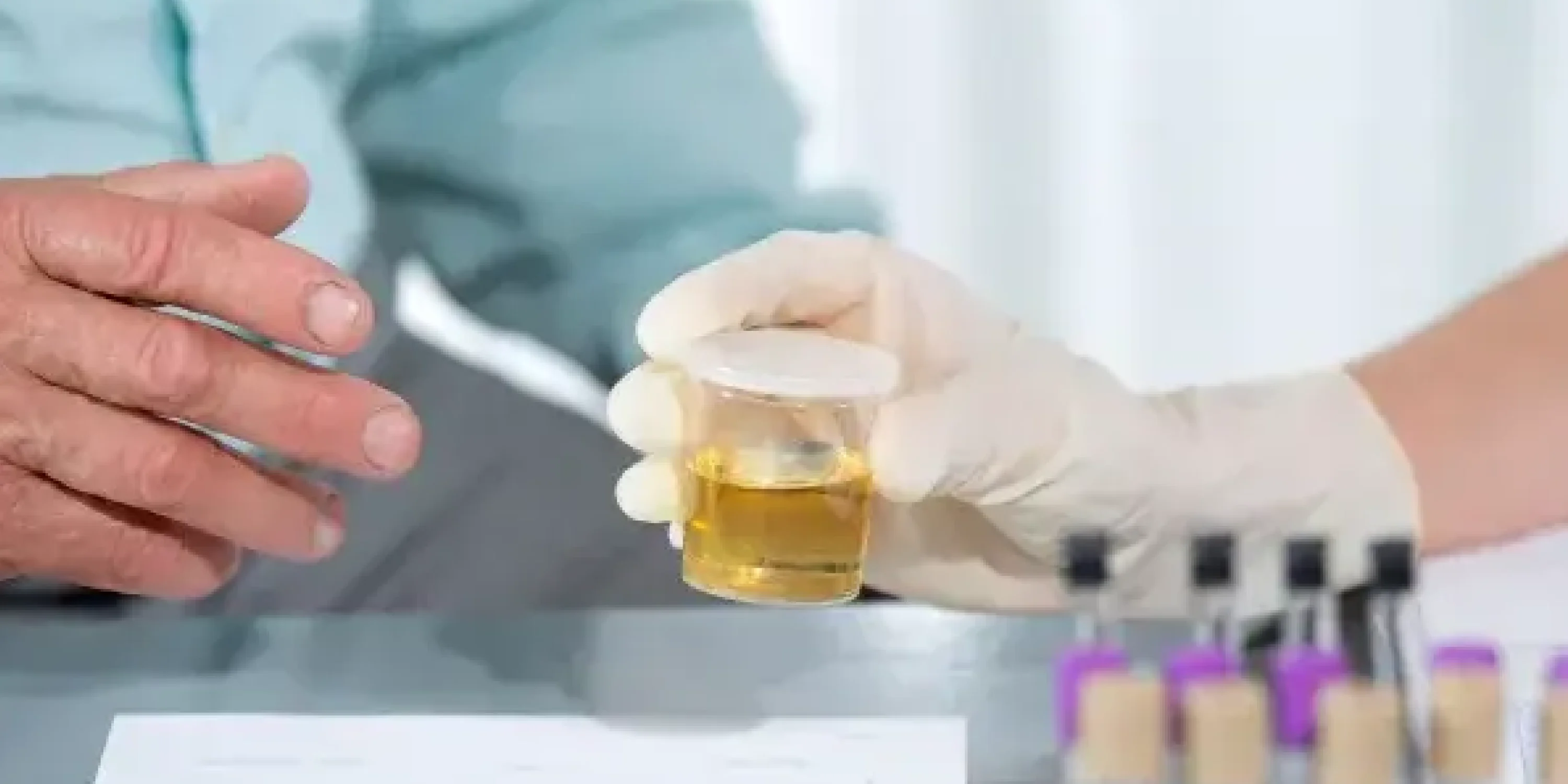 List of Foods That Can Cause a False Positive Drug Test | Blog | AttoSure